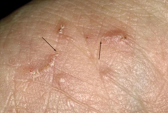 Syyhypunkin käytävä kämmensyrjässä